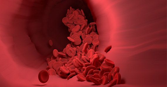 Hemoroidi oz. hemeroidi: Znaki, zdravila in zdravljenje | Lekarnar.com ...